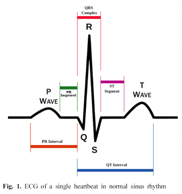 Cardiac Disease Detection Using Modified Pan-Tompkins Algorithm ...
