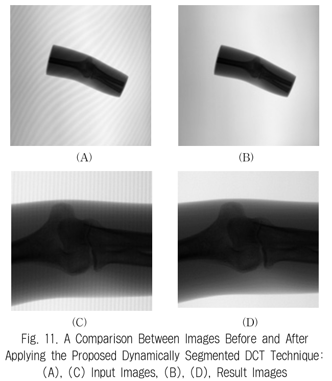 A Dynamically Segmented DCT Technique for Grid Artifact Suppression in ...